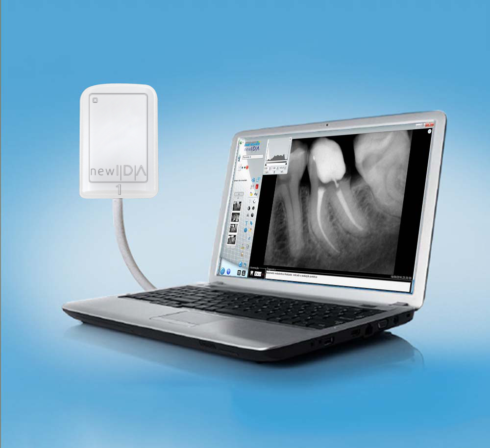 New IDA RVG Sensor – QMED IMAGING SDN BHD